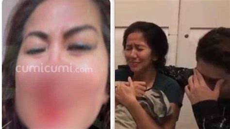 Deretan Artis Indonesia Jadi Korban Kdrt Suami Berujung Perceraian Ada Yang Tubuhnya Disayat