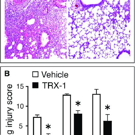 Effects Of Recombinant Human Thioredoxin Trx 1 Treatment On Cytokine Download Scientific