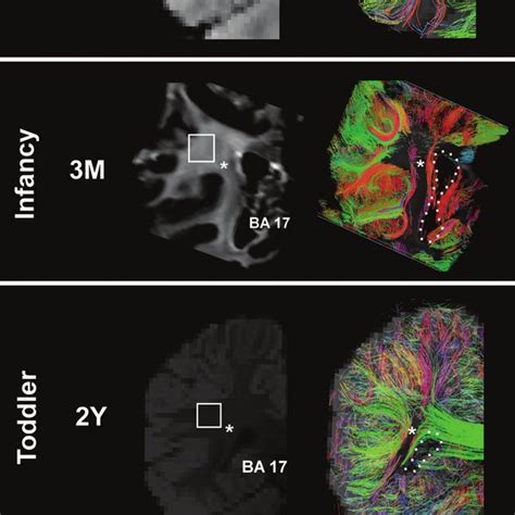 Hardi Images Right Are Presented With The Comparable Mean Diffusion