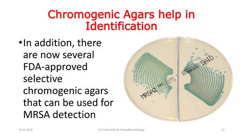 Screening For Mrsa Ppt