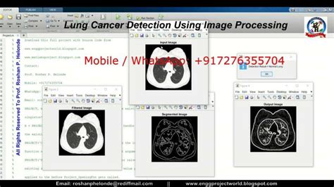 Prof Roshan Helonde On Linkedin Lung Cancer Detection Using Image Processing Lung Cancer