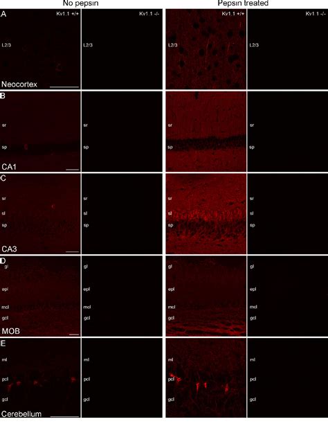 Axon Initial Segment Semantic Scholar