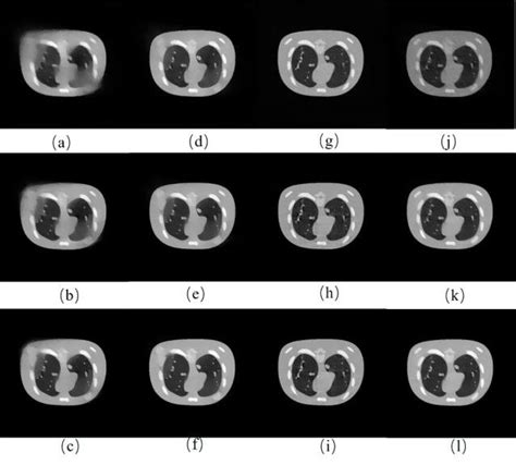 Limited Angle Ct Reconstruction Results From The Ncat Image On 90 Download Scientific Diagram