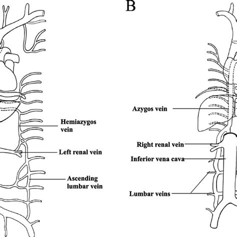 Schematic Sketch Of Venous System Picture A Shows That The Normal Ivc