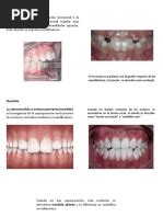 Curvas De Wilson Y Spee En Odontología Pdf Ortodoncia Odontología