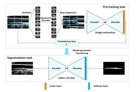 Ultrasound Carotid Plaque Segmentation Via Image Reconstruction Based Self Supervised Learning