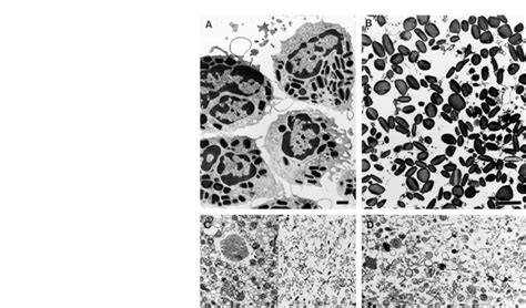 Eosinophils Microscope