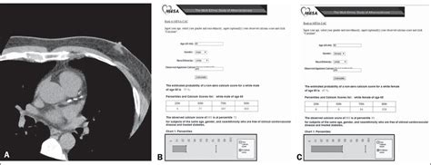 What Does The Percentile Mean In A Calcium Score At Callie Ellis Blog