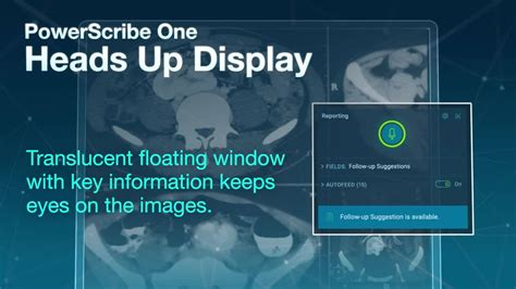 Powerscribe One Radiology Workflow And Reporting Solution Nuance Australia