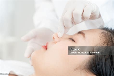 성형 수술 미용 외과 의사 또는 미용사가 여성의 얼굴을 만지고 코 모양을 바꾸는 수술 코 성형술 전에 환자의 코를 검사하는 의사 의료 지원 건강 코 성형에 대한 스톡 사진