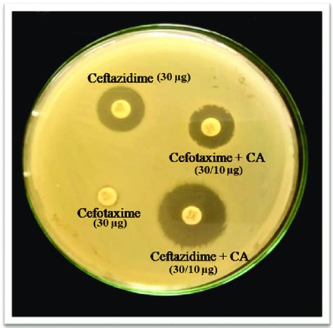 Phenotypic Confirmation Of Esbl Production Of E Coli Isolate Download Scientific Diagram