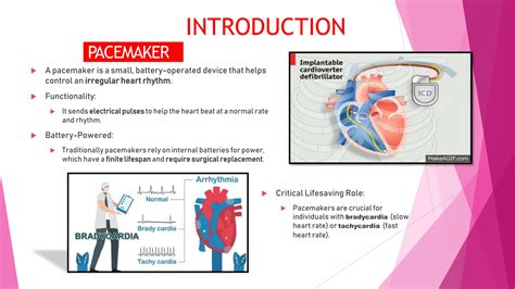 Wireless Charger For Implantable Pacemakers Pptx
