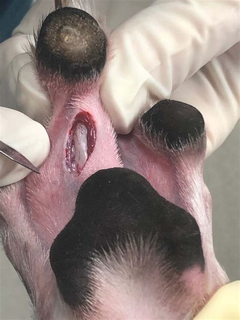 Superficial Flexor Digital Tenotomy Accepted Best Treatment For Corns