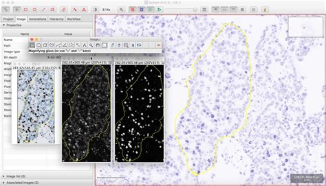 working with imagej · qupath qupath wiki · github