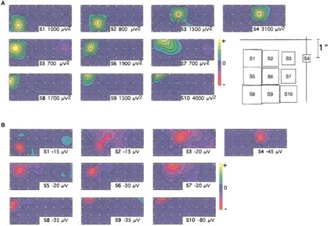 Spatial Distribution Of Gamma Activity Across The Cortical Space In V1