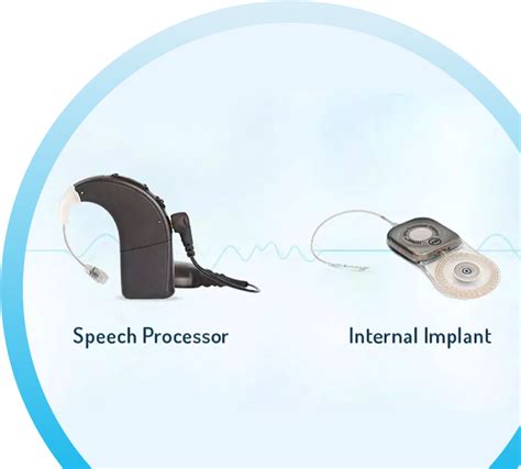 Cochlear Hearing Implants Cost In Singapore Free Consultation