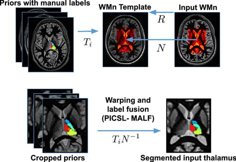 Structural Mri Based Parcellation Method Thomas 1 Manually Download Scientific Diagram