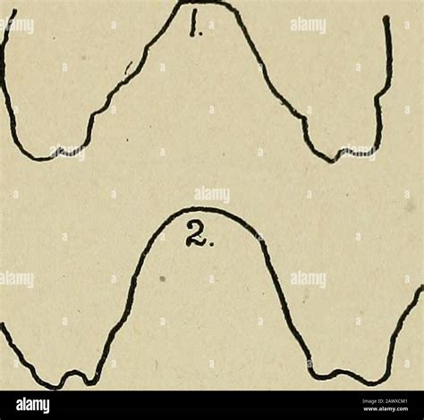 The Etiology Of Osseous Deformities Of The Head Face Jaws And Teeth