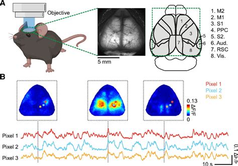 Parietal Cortex Mouse