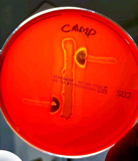 Gowtham Shanmugasundaram On Linkedin Microbiology