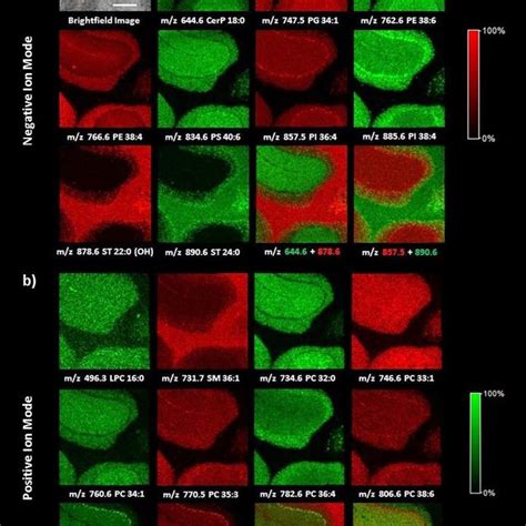 Novel Trimodal Maldi Imaging Mass Spectrometry Ims3 At 10 μm Reveals Spatial Lipid And Peptide