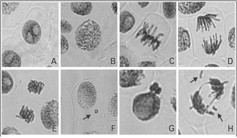 Normal Cells And Cells With Chromosomal And Nuclear Alterations