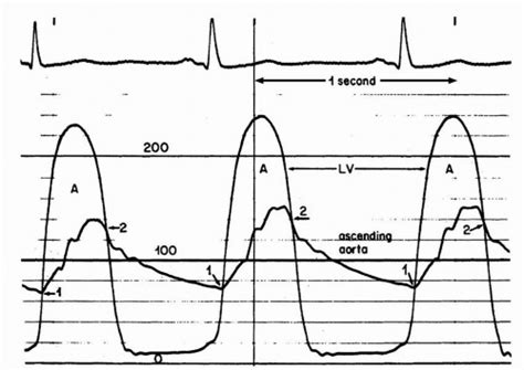CVT Module Post Quiz Flashcards Quizlet