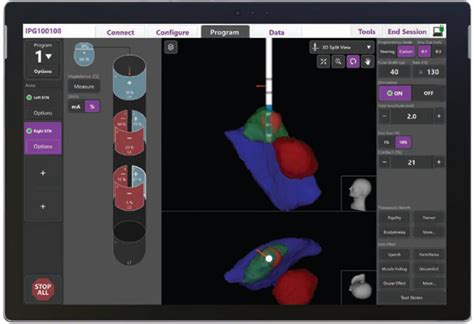新しい話題 慶應義塾大学病院 パーキンソン病センター