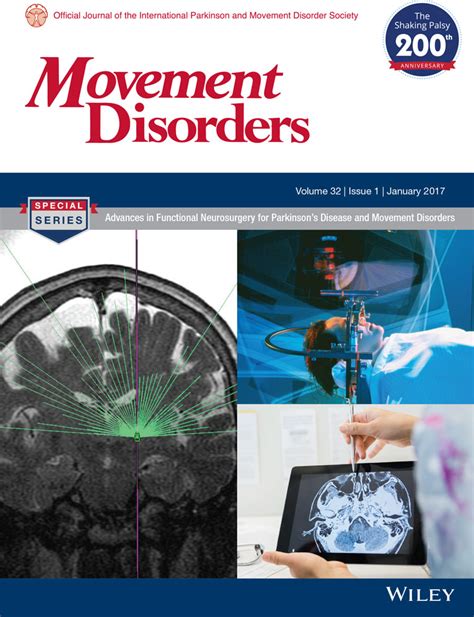 Oscillatory Beta Power Correlates With Akinesia‐rigidity In The