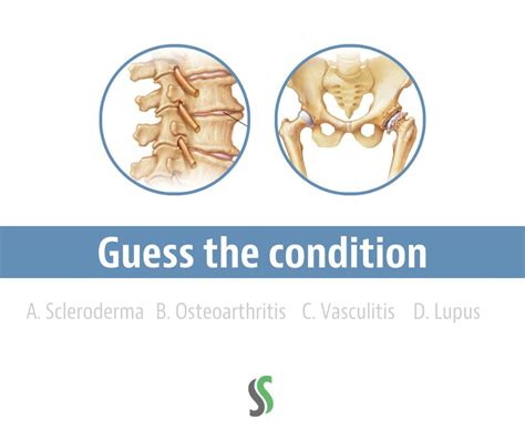 Arthritis And Rheumatology Associates Of South Jersey Pc On Linkedin Guess The Condition A