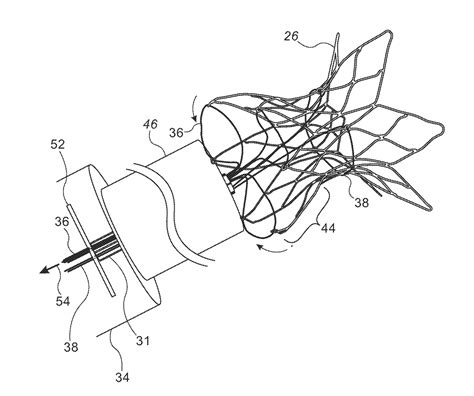 Atriocaval Shunt Patented Technology Retrieval Search Results Eureka Patsnap