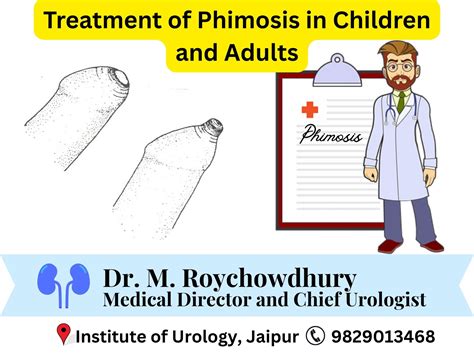 What Is Epididymo Orchitis