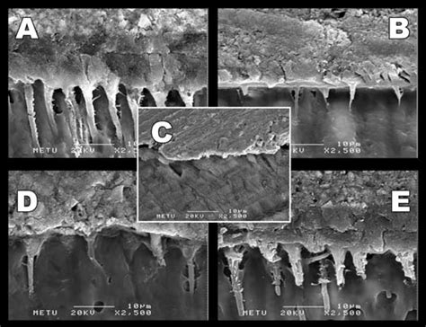 Representative Sem Micrographs Of The Tooth Restoration Interface In Download Scientific