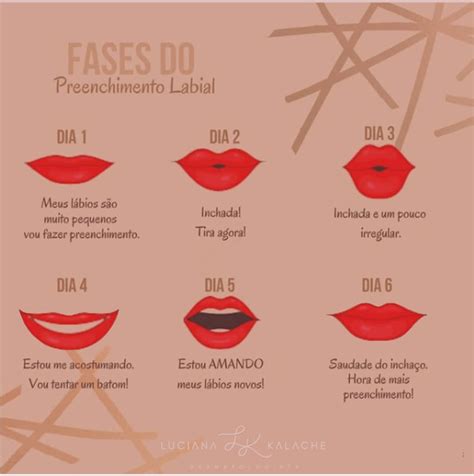 Fases Do Preenchimento Labial👄 O Dra Luciana Kalache