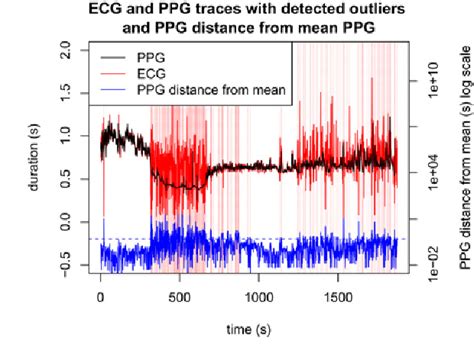 Figure 2 From Profiling The Propagation Of Error From Ppg To Hrv