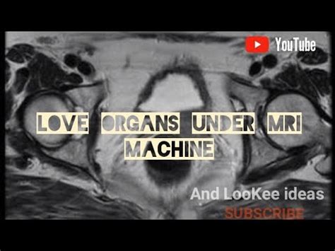 как выглядит секс под рентгеном YouTube