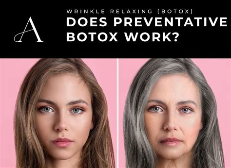 How Long Does Botox Last Timeline Results And Expert Tips Aesthetics By Stephanie Livingston