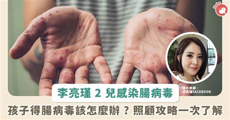 李亮瑾 2 寶患腸病毒！全身紅疹、食不下嚥怎麼辦？家長照顧策略一次看 蕃新聞