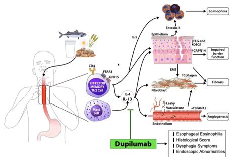 Eosinophilia Treatment Effect Of Dupilumab On Blood Eosinophil Counts