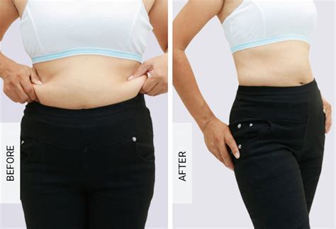 Ultrasonic Cavitation In Staten Island Ultrasound Fat Cavitation Nyc