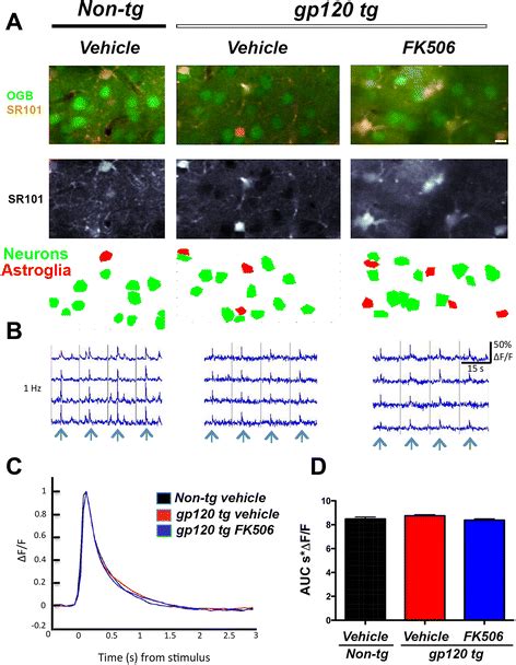 Calcium Dynamics By Live Imaging In The Barrel Cortex Neurons In Gp120 Download Scientific