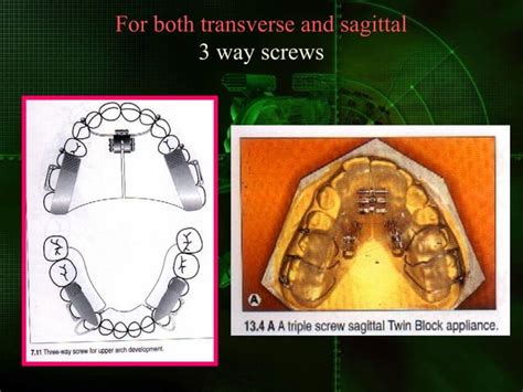 Twin Block Effects Ppt