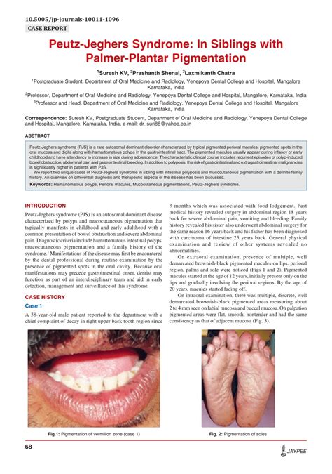 Pdf Peutz Jeghers Syndrome In Siblings With Palmer Plantar