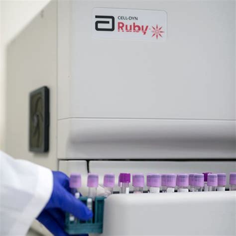 Cell Dyn Ruby Hematology System For Medium Volume Laboratories Core Laboratory At Abbott