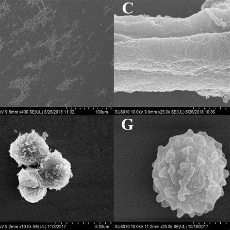 Sem Analysis Of The Antagonistic Effects Of L Plantarum Iamu80070 Download Scientific Diagram