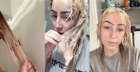 Diy Bleaching Made Woman Lose Most Of Her Hair She Emotionally Broke