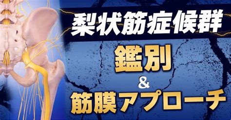 【梨状筋症候群】解剖から紐解く鑑別とandq 理学療法士・作業療法士・言語聴覚士の求人、セミナー情報なら【post】