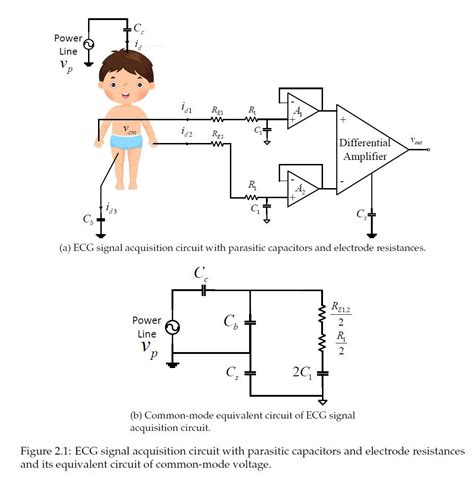 Learn About Ecg Signal Acquisition Circuit Mindy Hu Posted On The Topic Linkedin