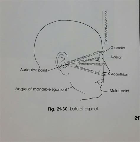 Skull Positioning Artofit