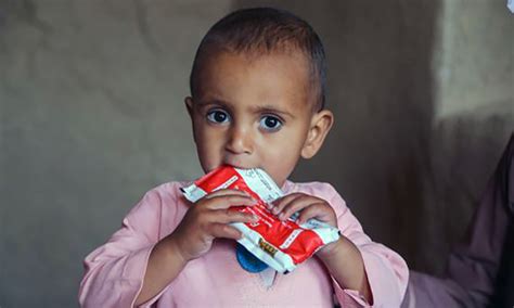یونیسف از درمان بیش از ۴۷۵ هزار کودک مبتلا به سوء‌تغذیه در سال جاری خبر داد خبرگزاری خامه پرس